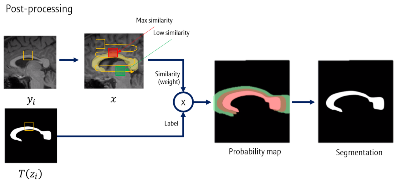 Atlas based method / Label fusion
